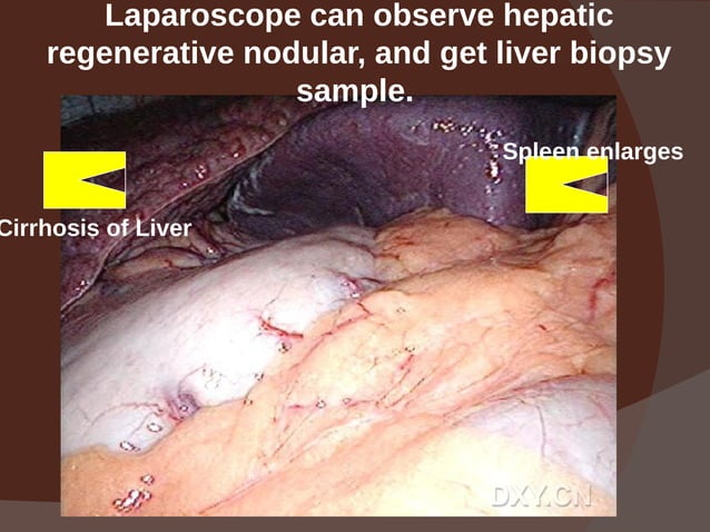 bai-giang benh-hoc-xo-gan.pdf