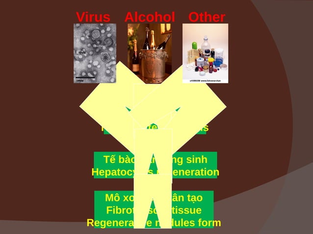 bai-giang benh-hoc-xo-gan.pdf