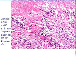 thực hành GPB 1 (HPMU) | PPT
