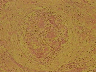 thực hành GPB 1 (HPMU) | PPT