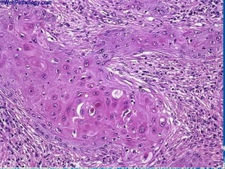 thực hành GPB 1 (HPMU) | PPT