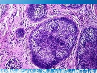 thực hành GPB 1 (HPMU) | PPT