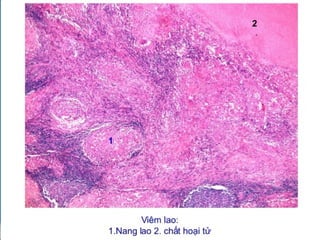 thực hành GPB 1 (HPMU) | PPT