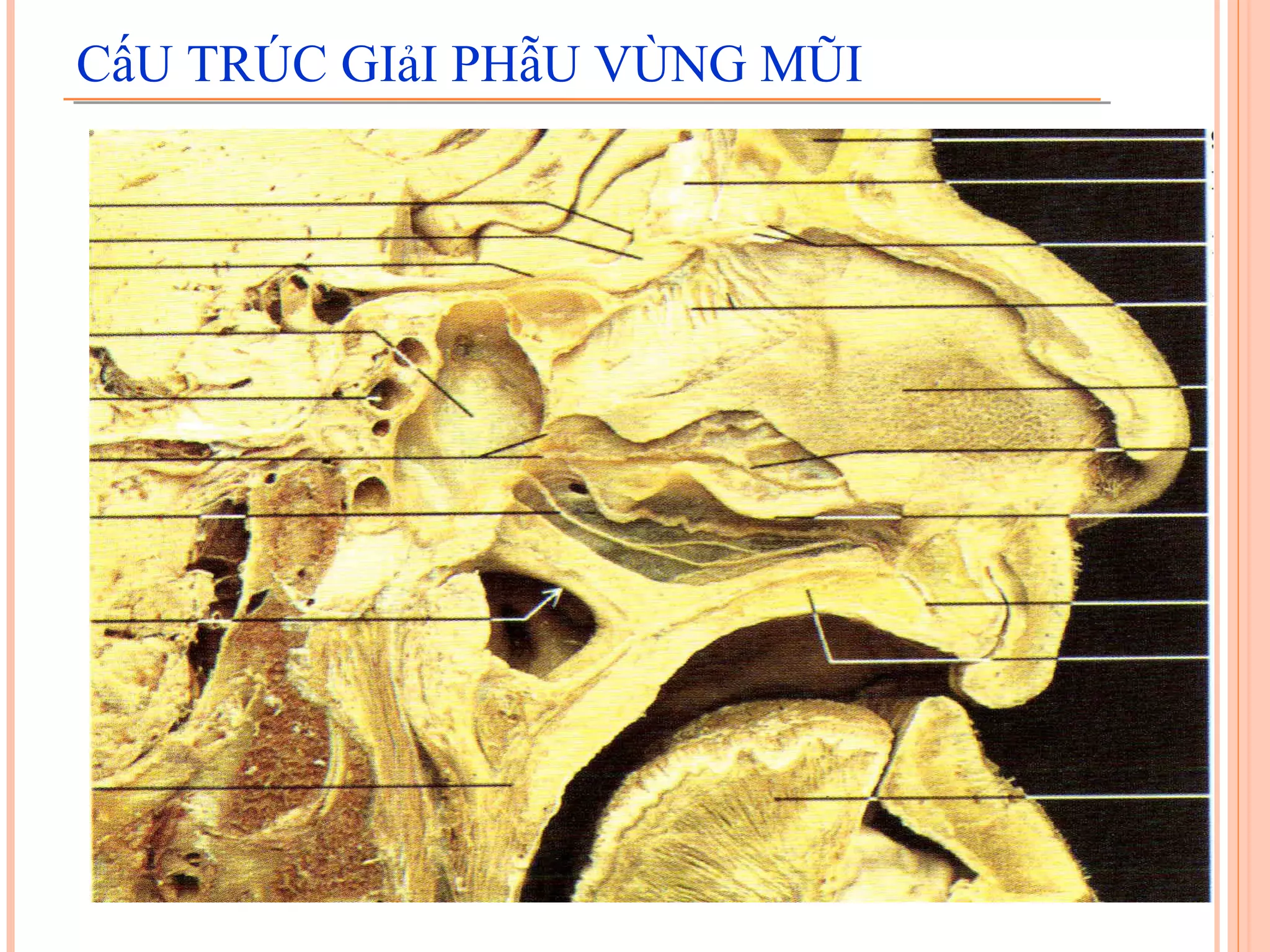 Tai mui hong | PPT