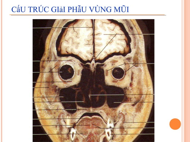 Tai mui hong | PPT