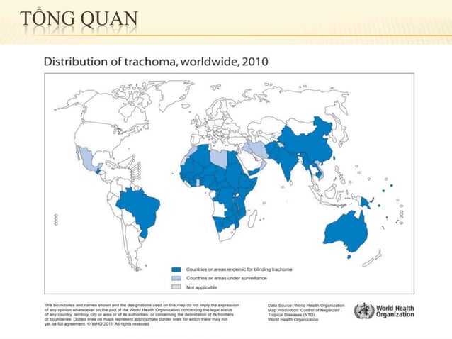 Bai 332 dau mat hot | PPT
