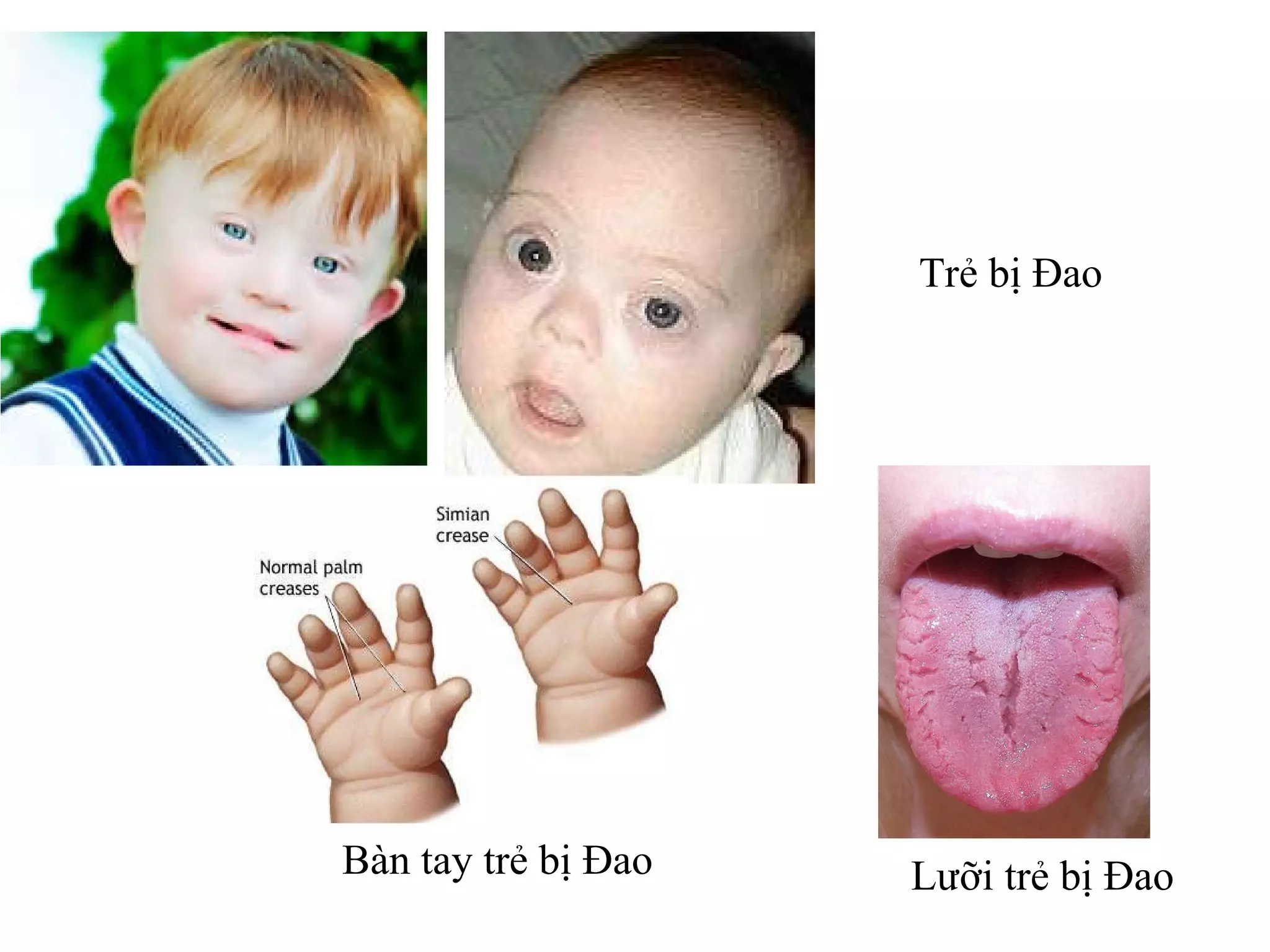 BÀI 6: ĐỘT BIẾN SỐ LƯỢNG NHIỄM SẮC THỂ | PPT