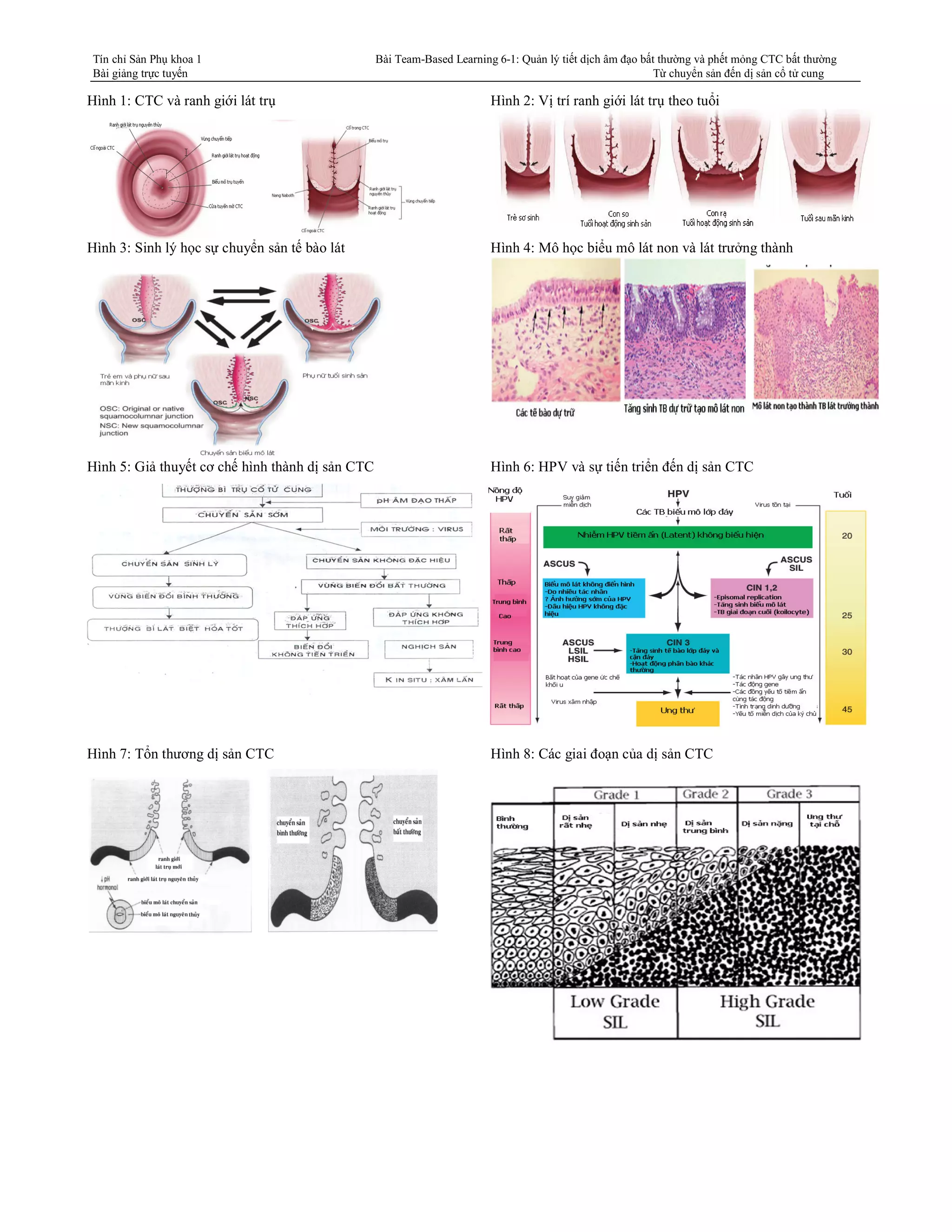 QUẢN LÝ TIẾT DỊCH ÂM ĐẠO BẤT THƯỜNG VÀ PHẾT MỎNG CỔ TỬ CUNG BẤT THƯỜNG TỪ CHUYỂN SẢN ĐẾN DỊ SẢN ...