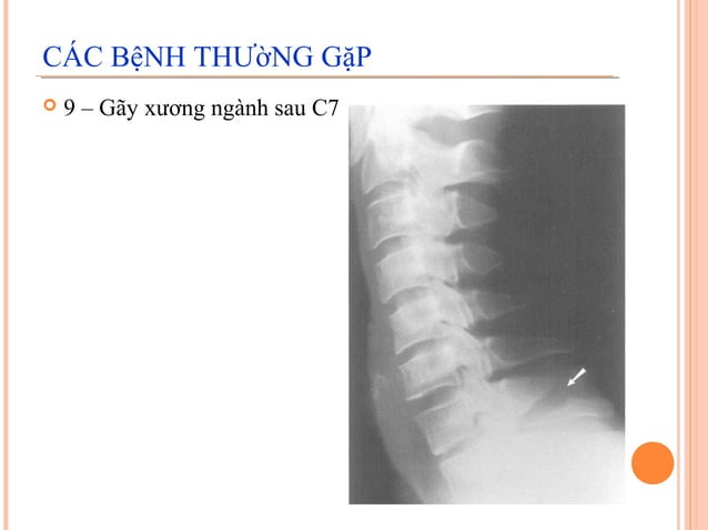 Cac benh da co xuong | PPT