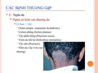 Cac benh da co xuong | PPT