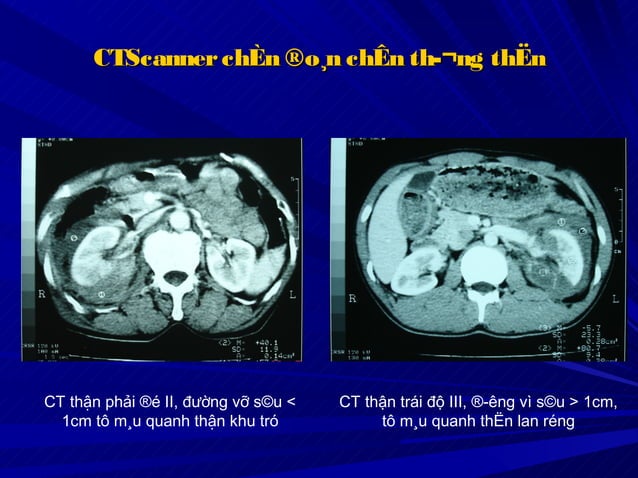 Bai giang ct than y4 | PPT