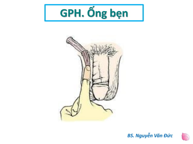 GIẢI PHẪU ỐNG BẸN | PDF