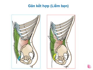 GIẢI PHẪU ỐNG BẸN | PDF
