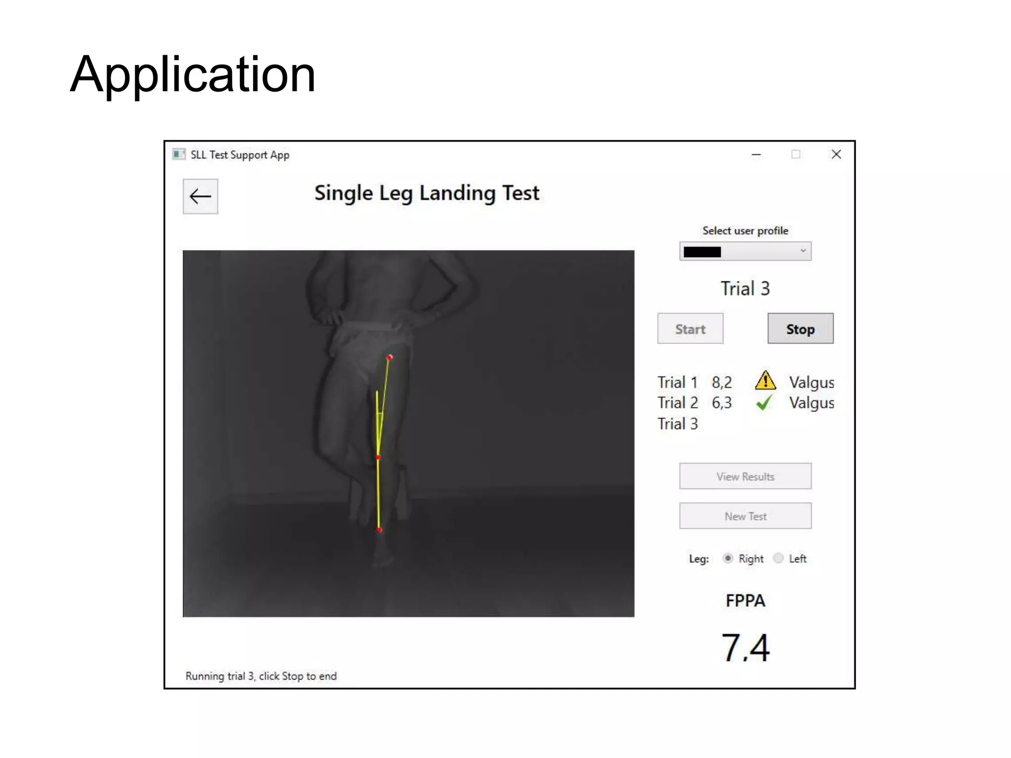 First Approach to Automatic Measurement of Frontal Plane Projection ...