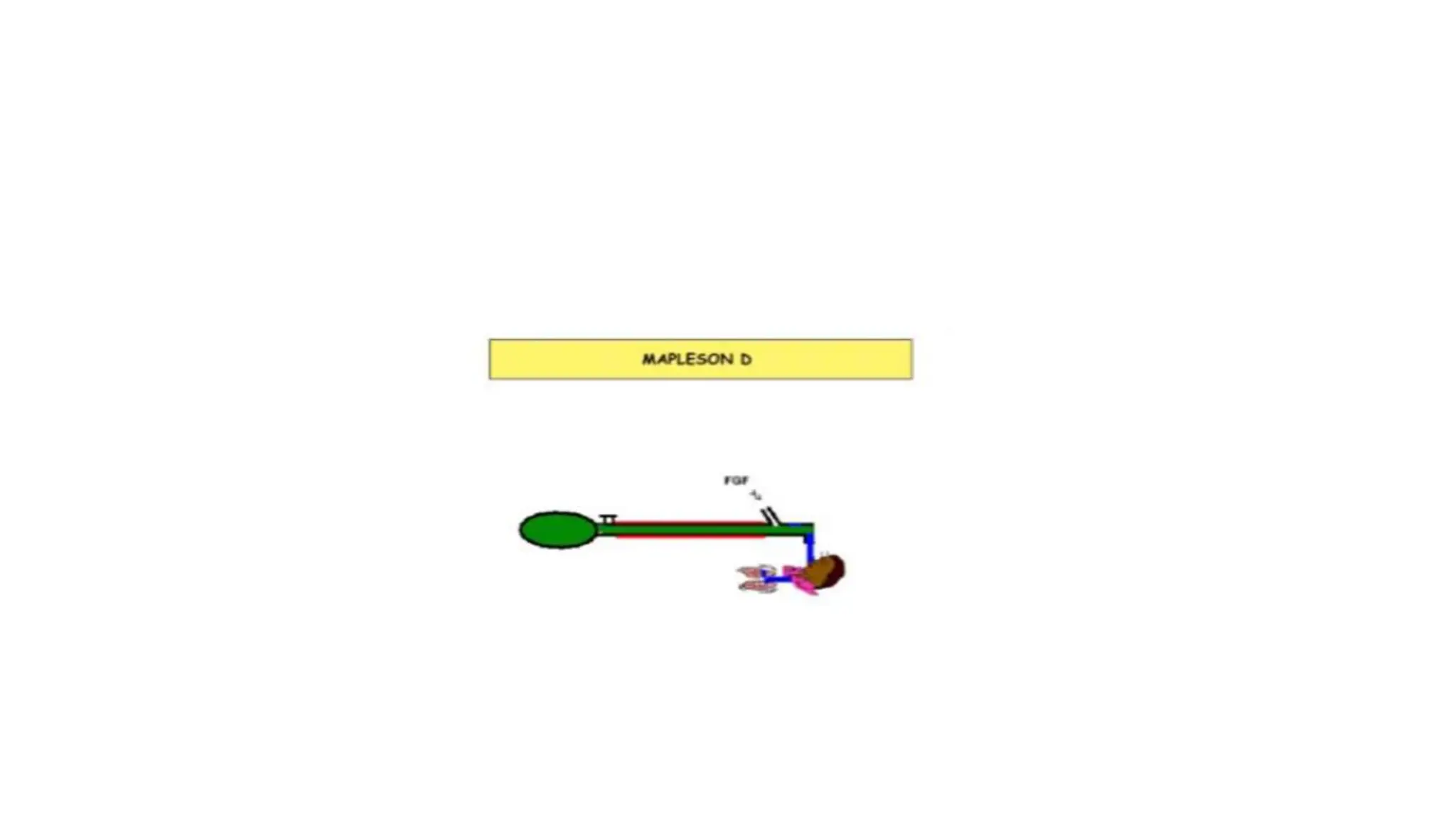 Bains Circuit Mapelson D By Zikrullah Mallick Pptx
