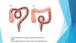 baiscs of colonoscopy.pptx