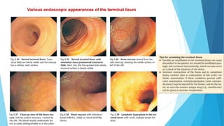 baiscs of colonoscopy.pptx
