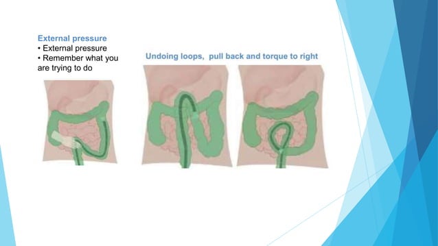 baiscs of colonoscopy.pptx