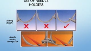 Baisc surgical skills, sututres and needles 1.pptx