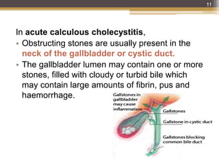 Cholecystitis & carcinoma of gallbladder | PPTX