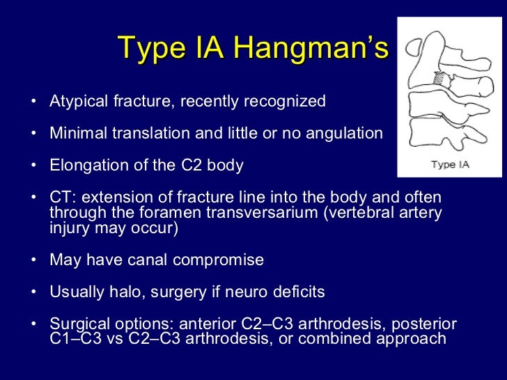 Bajammal 2006 Upper Cervical Trauma