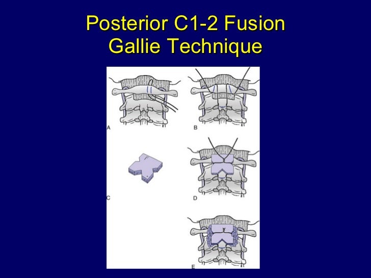 Bajammal 2006 Upper Cervical Trauma