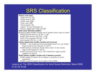 Adult Degenerative Scoliosis 2008 | PDF