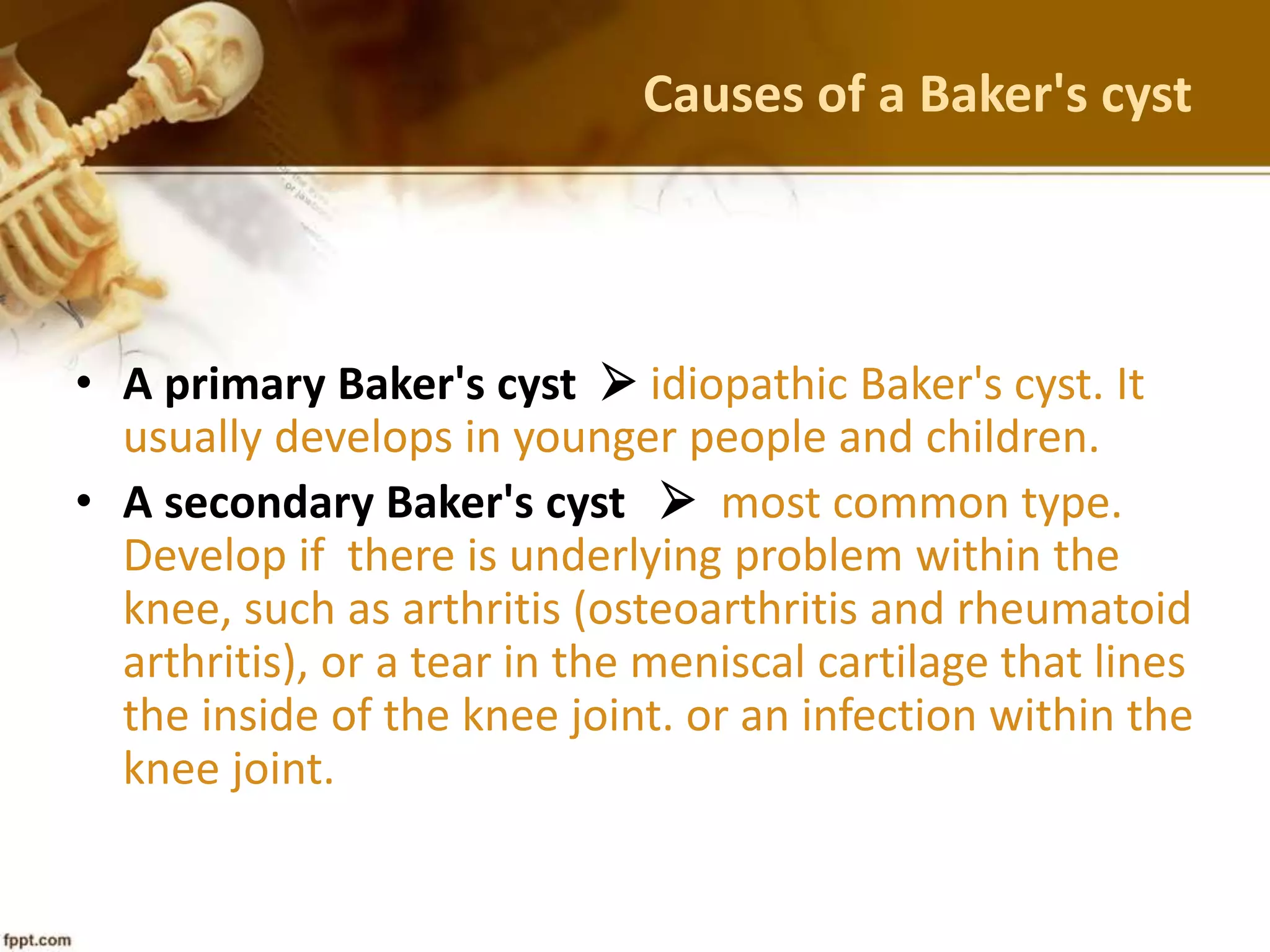 Baker's cyst | PPTX