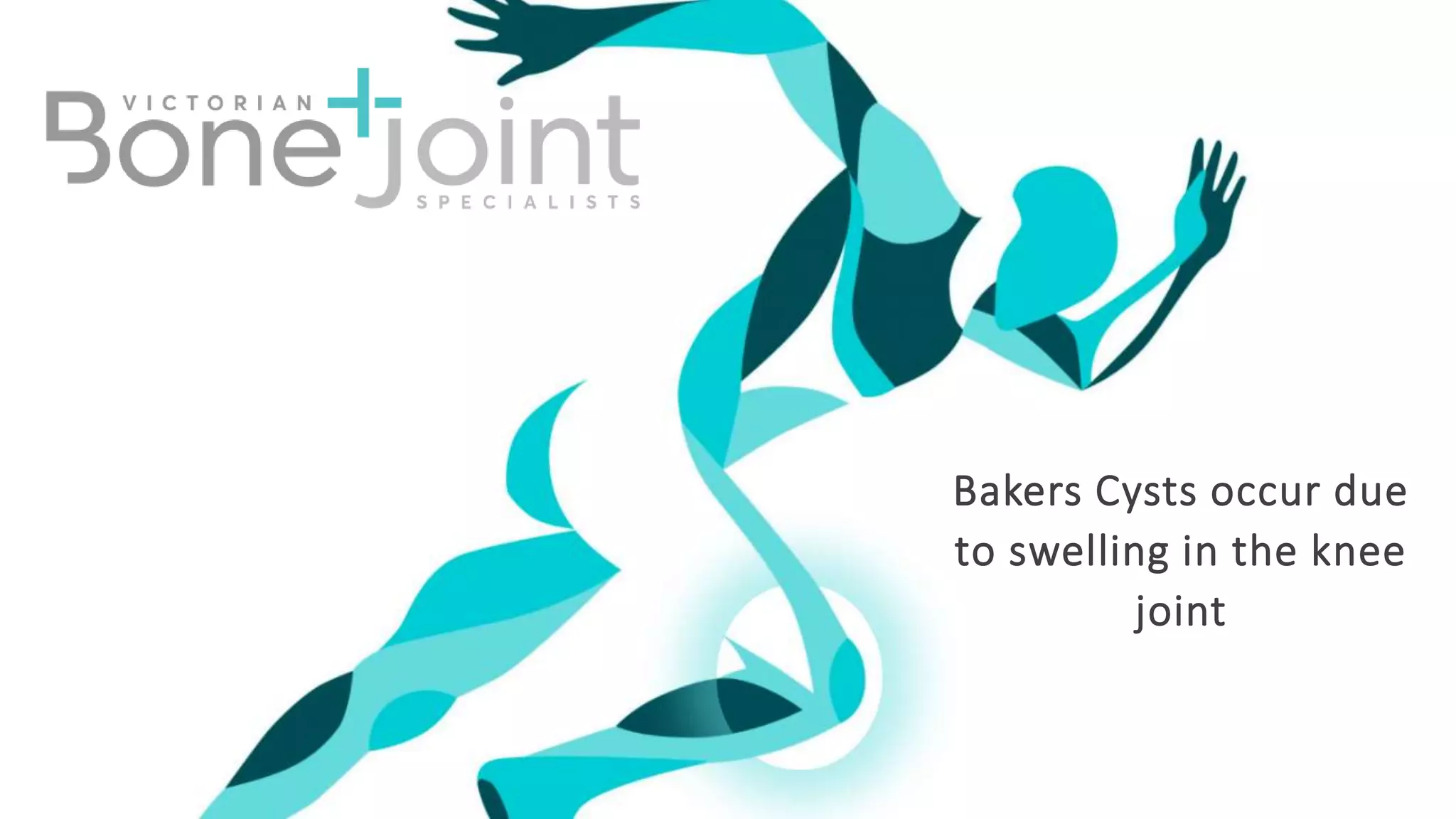 Bakers cyst | PPTX