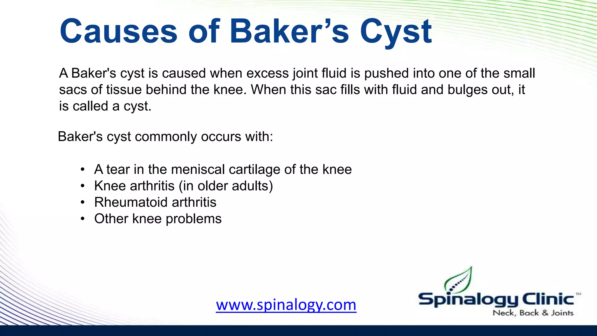 Bakers cyst symptoms, causes, diagnosis, & treatment | PPTX