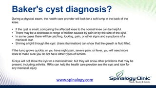 Bakers cyst symptoms, causes, diagnosis, & treatment | PPT