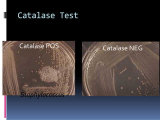 Bakteriologi infeksi kulit & jaringan lunak (S1 FK UNAIR) | PPT