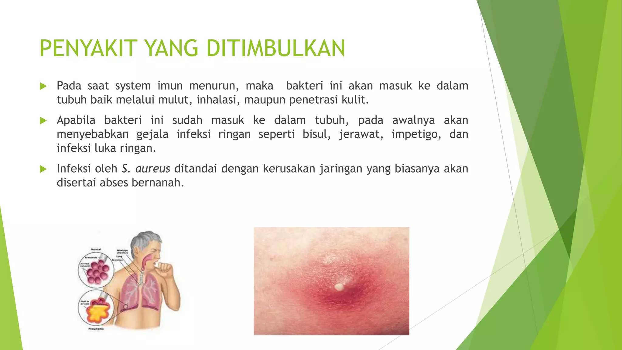 Bakteri Staphylococcus aureus | PPTX