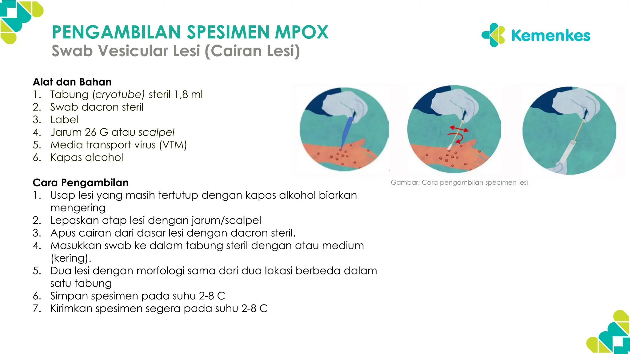 Balai Besar Laboratorium Biologi Kesehatan Kementerian Kesehatan- Penatalaksanaan Spesimen MPOX ...
