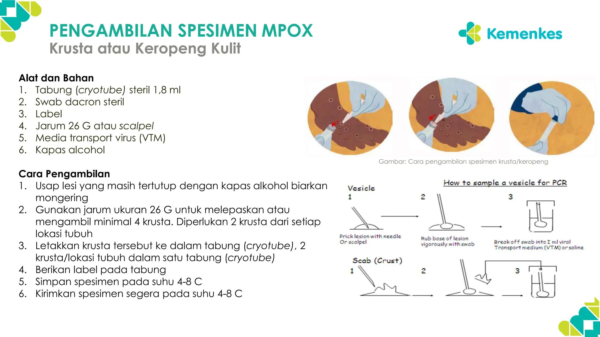 Balai Besar Laboratorium Biologi Kesehatan Kementerian Kesehatan- Penatalaksanaan Spesimen MPOX ...