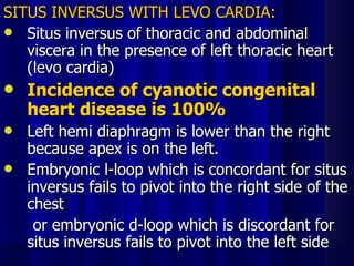 ECG: Cardiac Malpositions | PPT