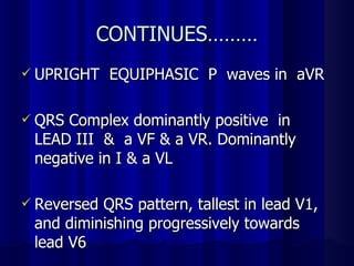 ECG: Cardiac Malpositions | PPT