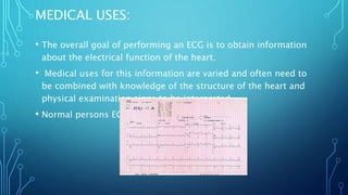 ECG | PPTX