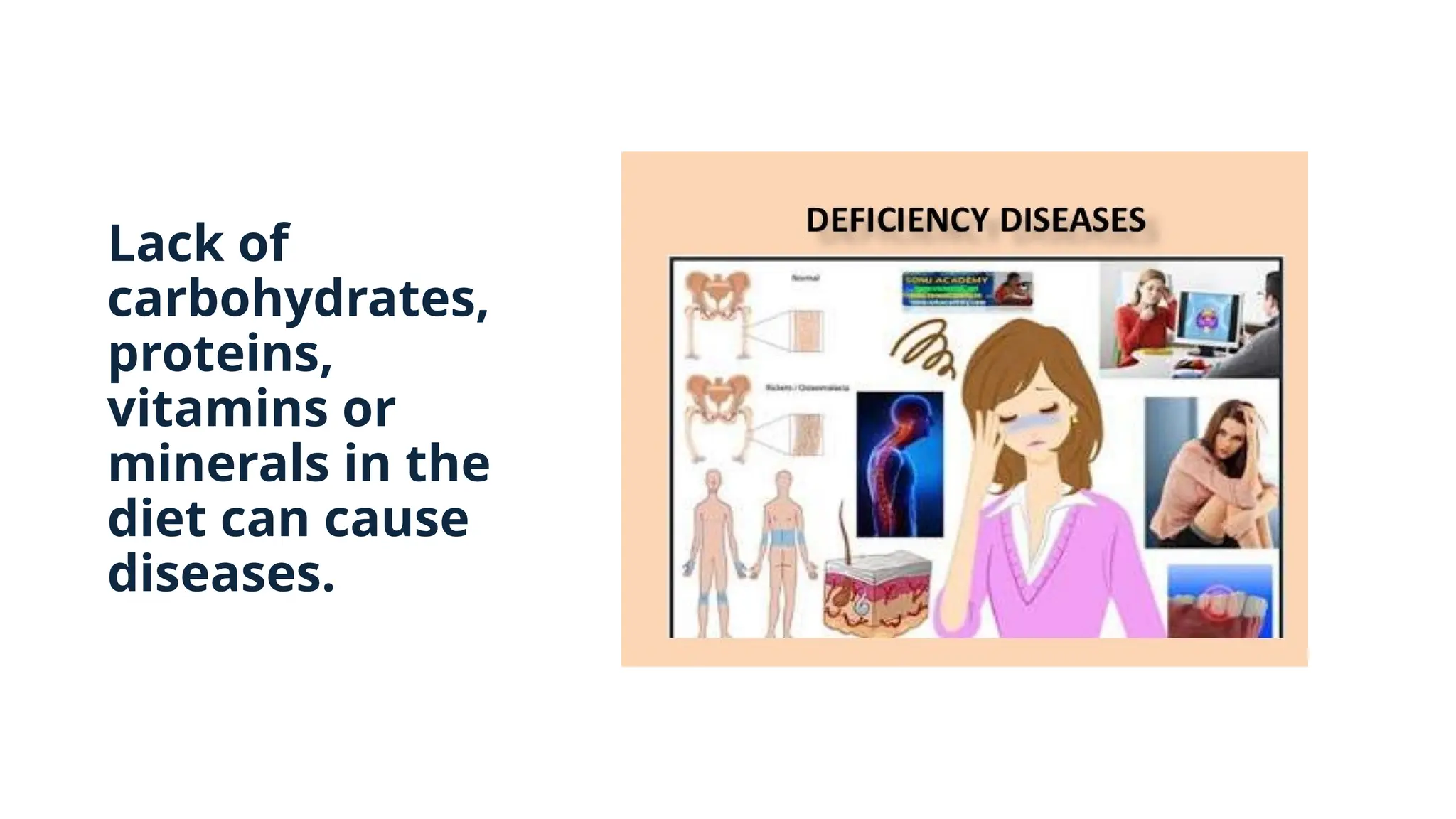Balanced Diet for the human beings and the diet style | PPT