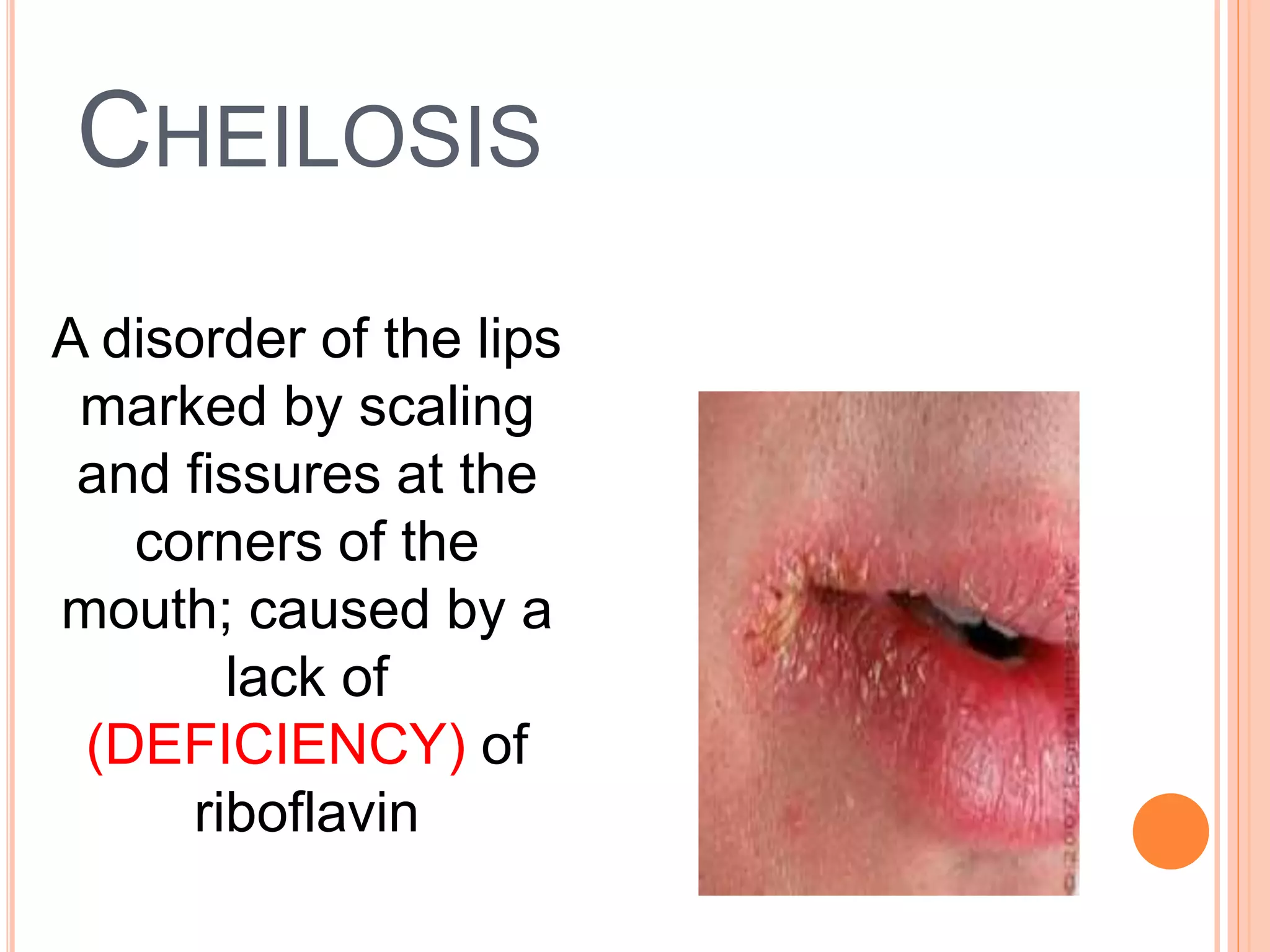 Balanced diet ppt | PPTX