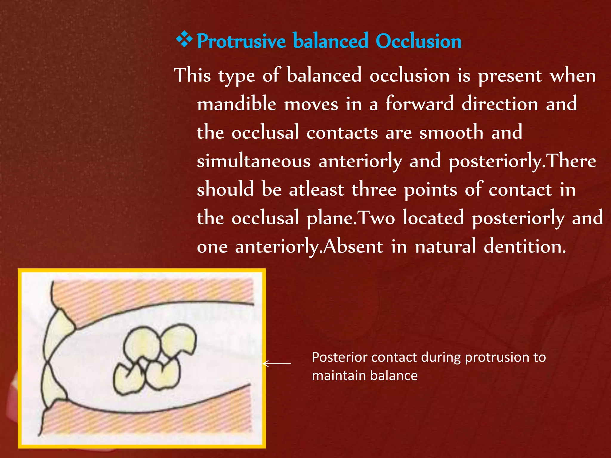 Balanced occlusion - Prosthodontics | PPTX