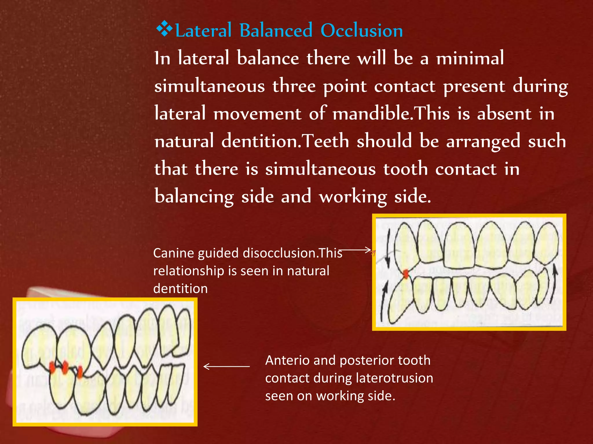 Balanced occlusion - Prosthodontics | PPTX