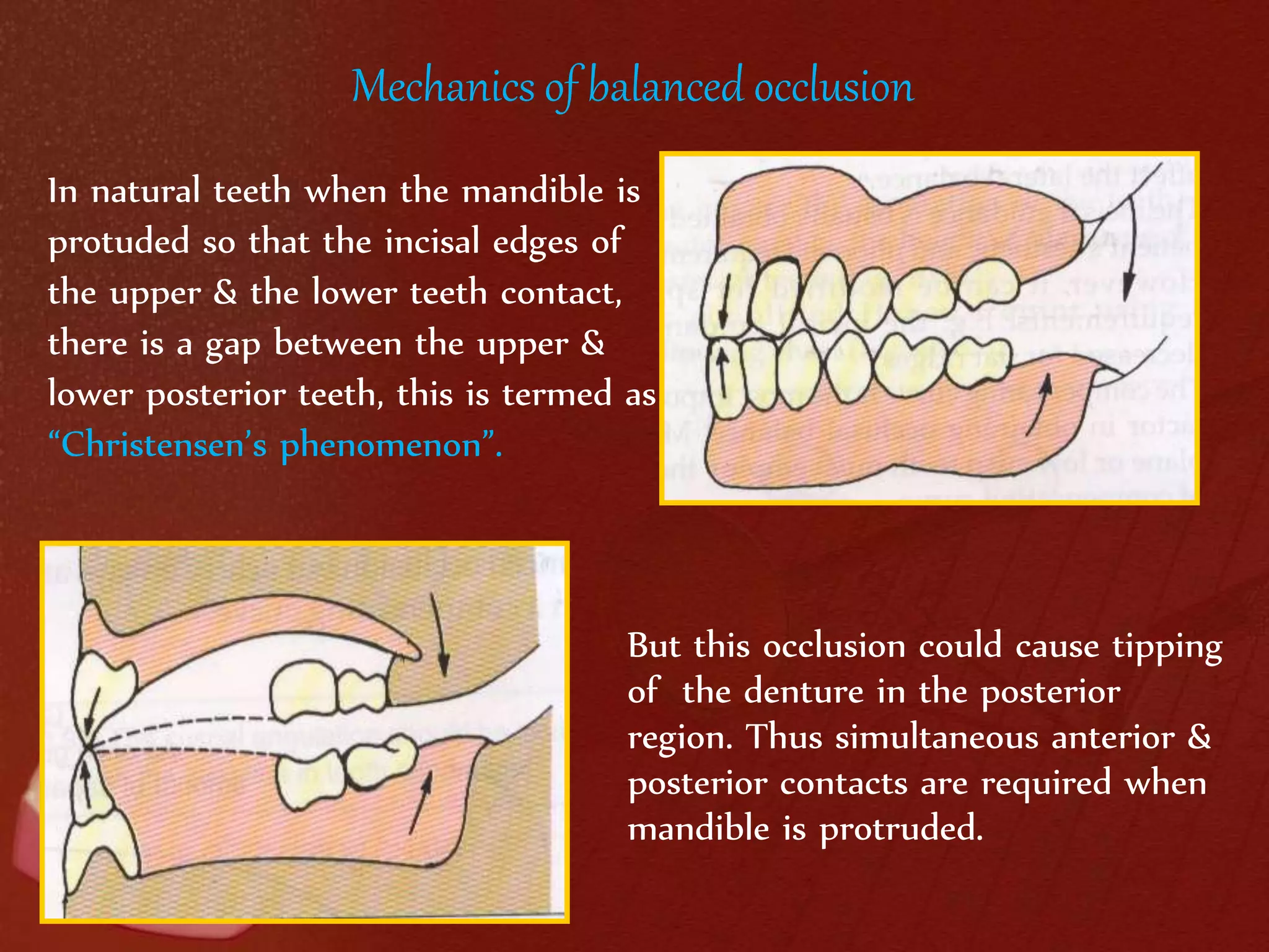 Balanced occlusion - Prosthodontics | PPTX
