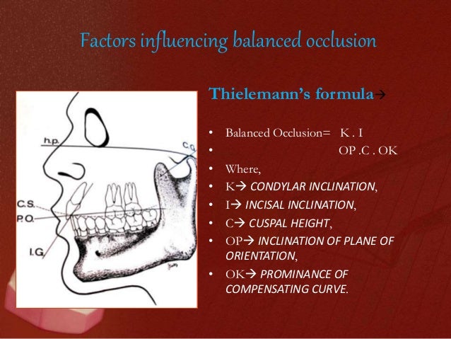Balanced occlusion - Prosthodontics