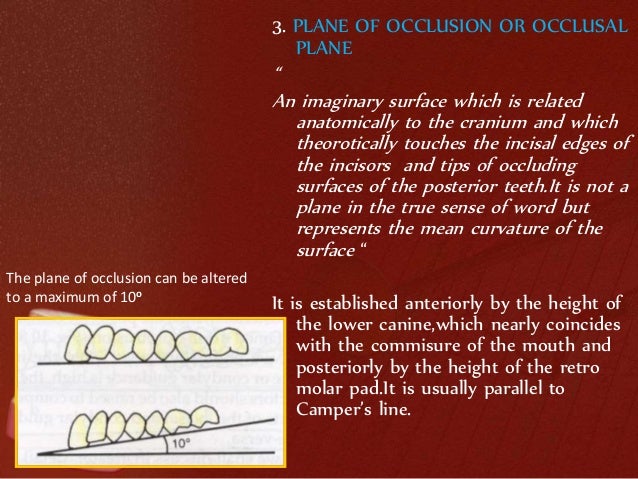 Balanced occlusion - Prosthodontics