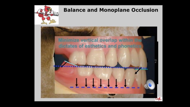 Balanced occlusion | PPTX | Dental Health | Diseases and Conditions