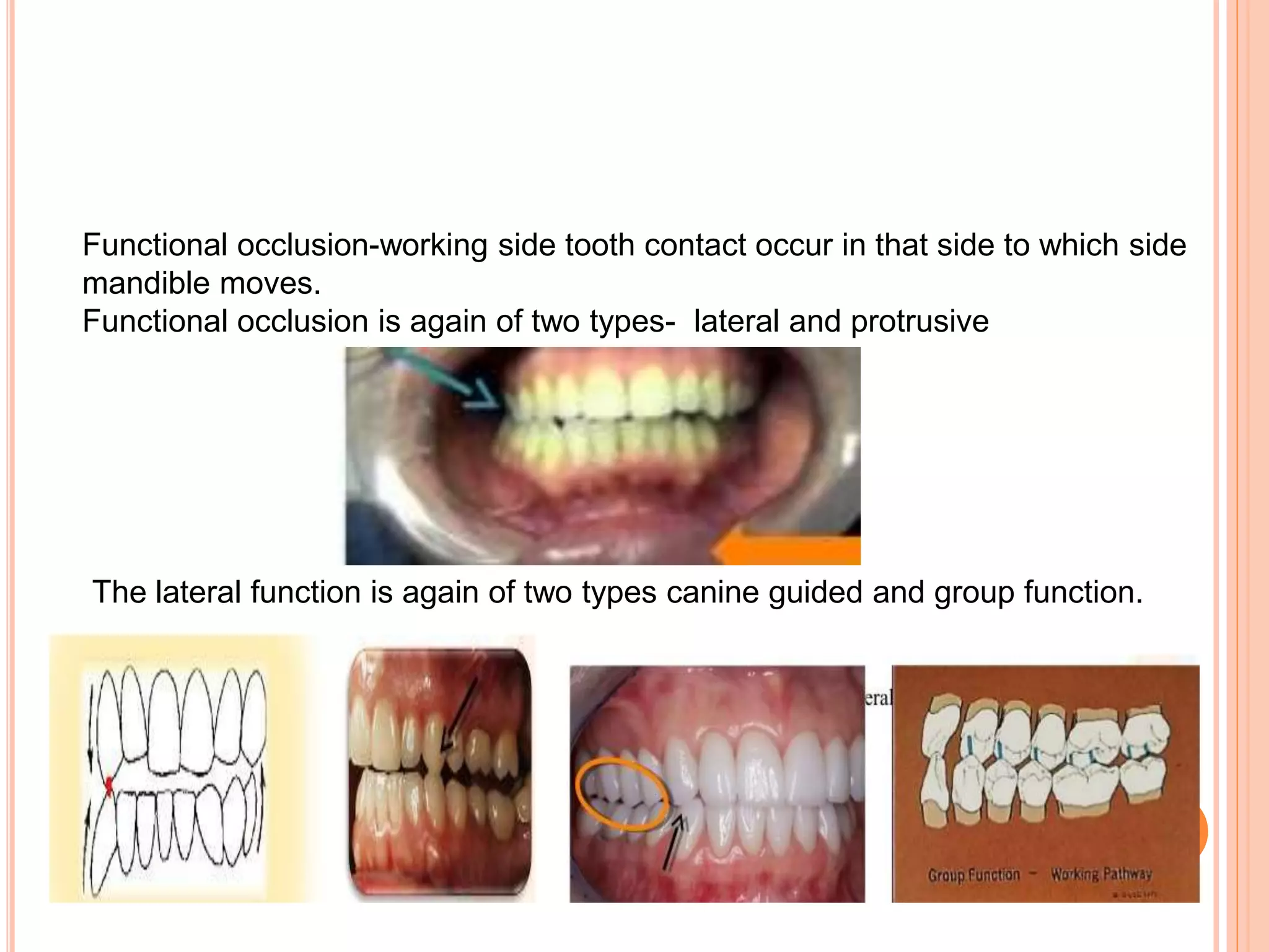 Balanced occlusion | PPTX