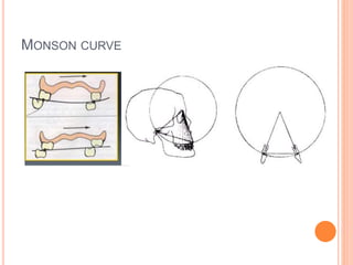 Balanced occlusion | PPTX