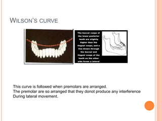 Balanced occlusion | PPTX