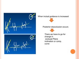 Balanced occlusion | PPTX